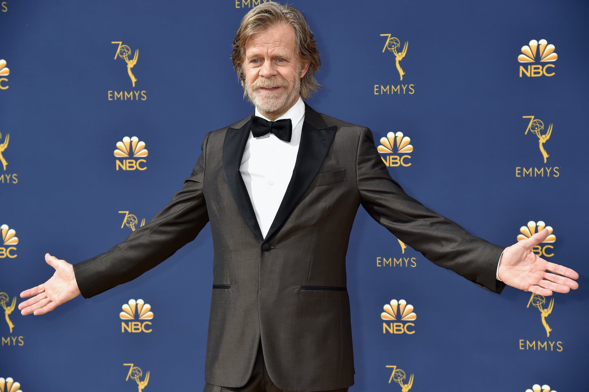 'Shameless': William H. Macy Earns an Estimated $350,000 Per Episode