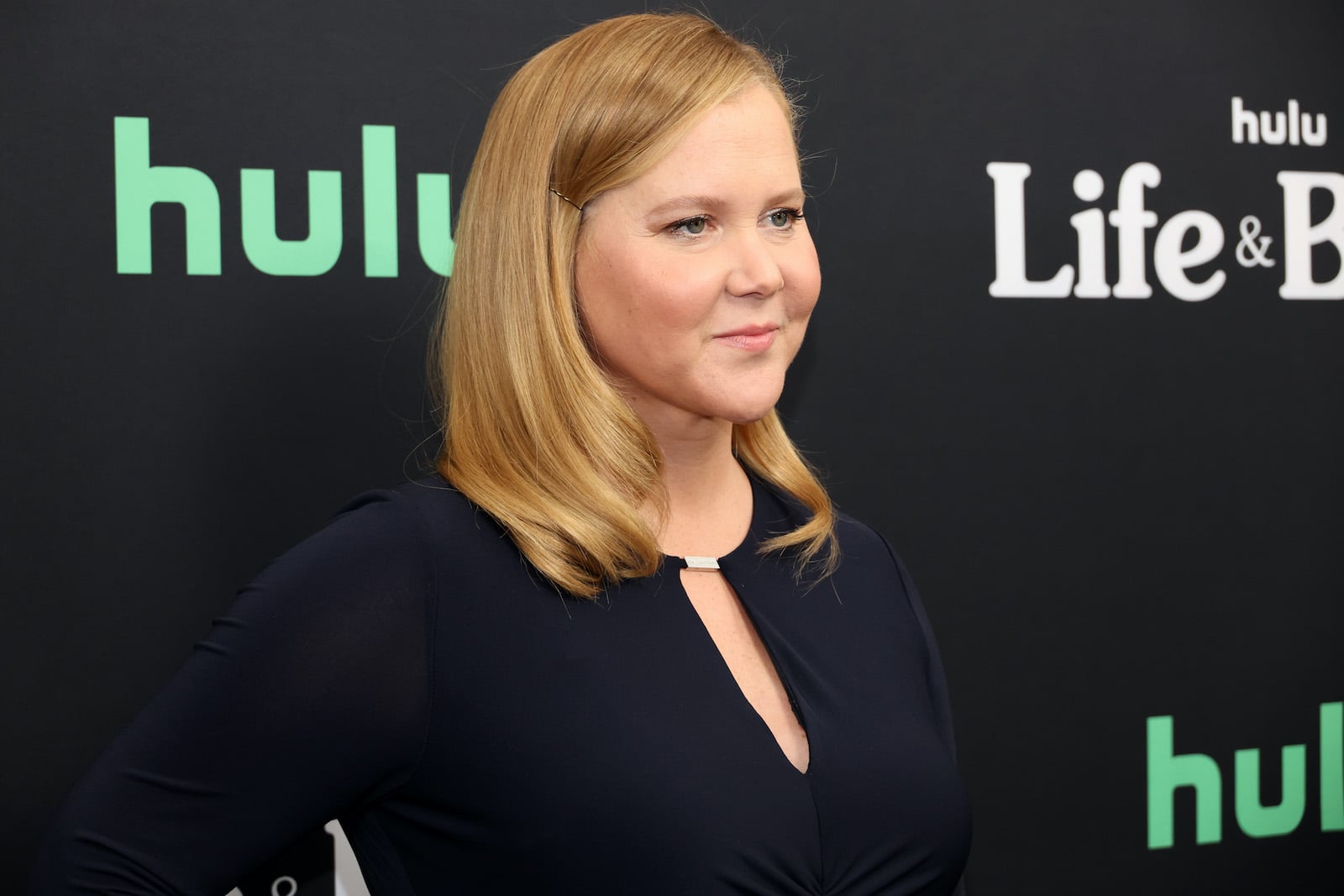 'Life & Beth': Amy Schumer Reveals Real-Life Fish Hook Scene Complete ...